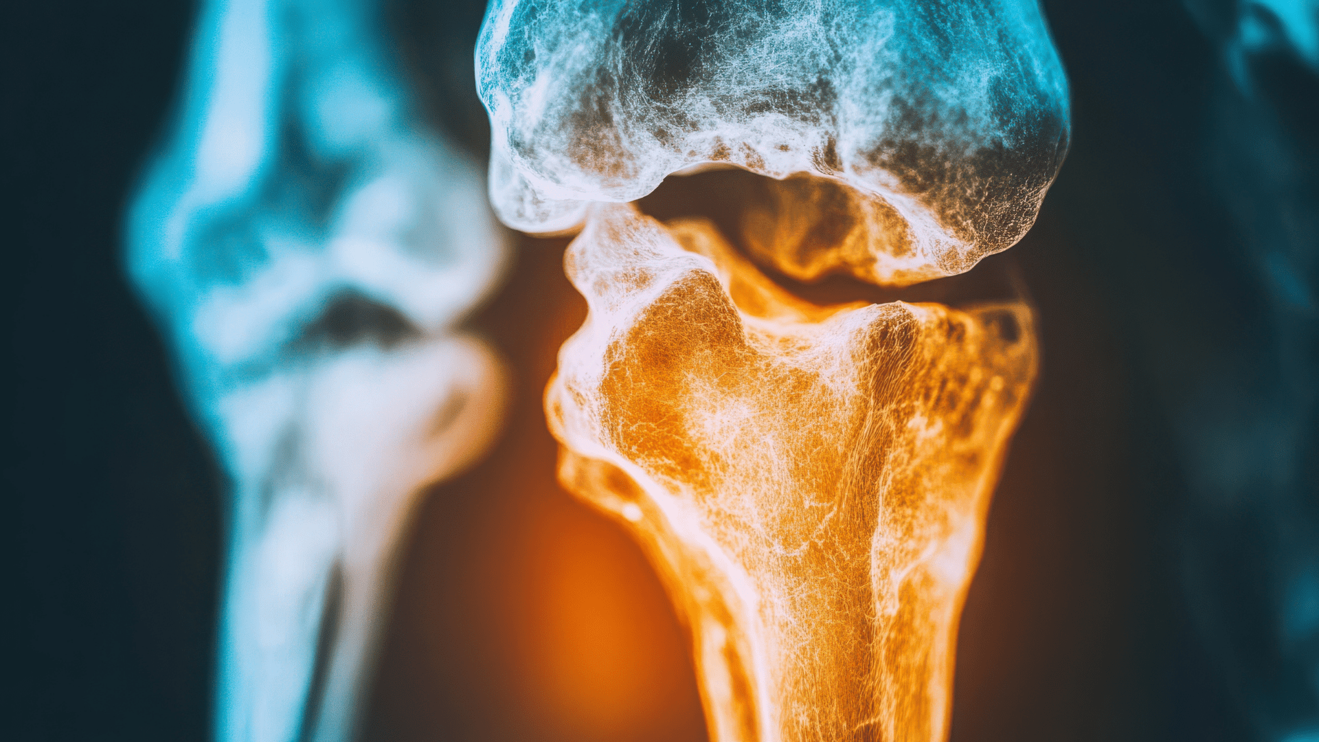 Turmeric for Joint Health: Mobility, Pain, and Curcumin Research